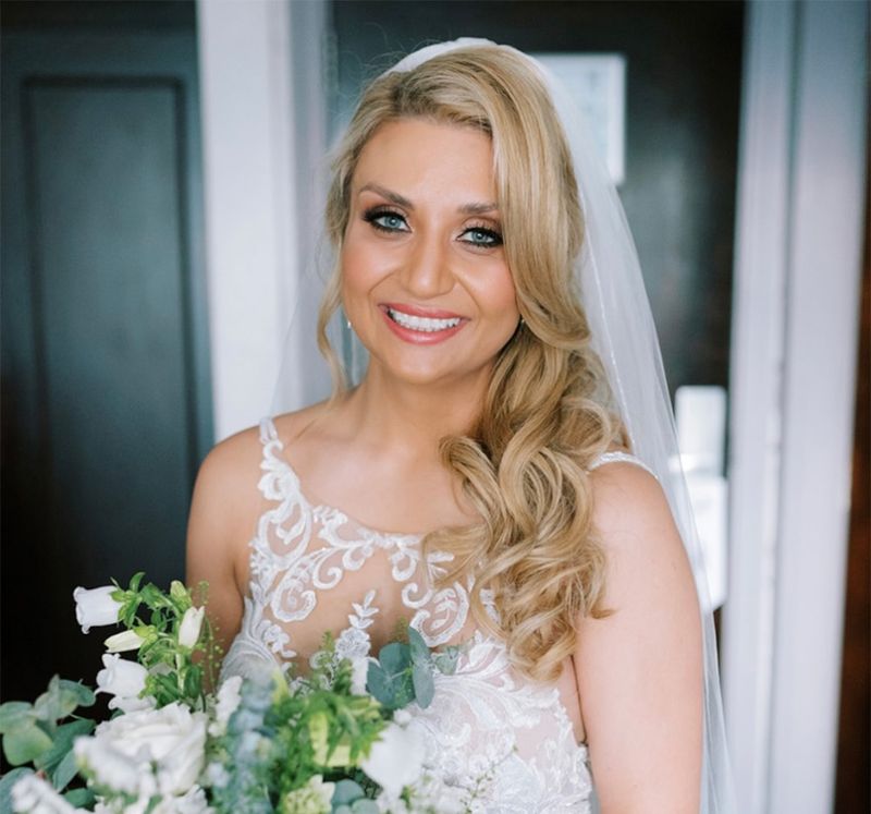 Your Wedding Smile | Wedding Smile Makeover | Wedding Teeth In Dublin ...