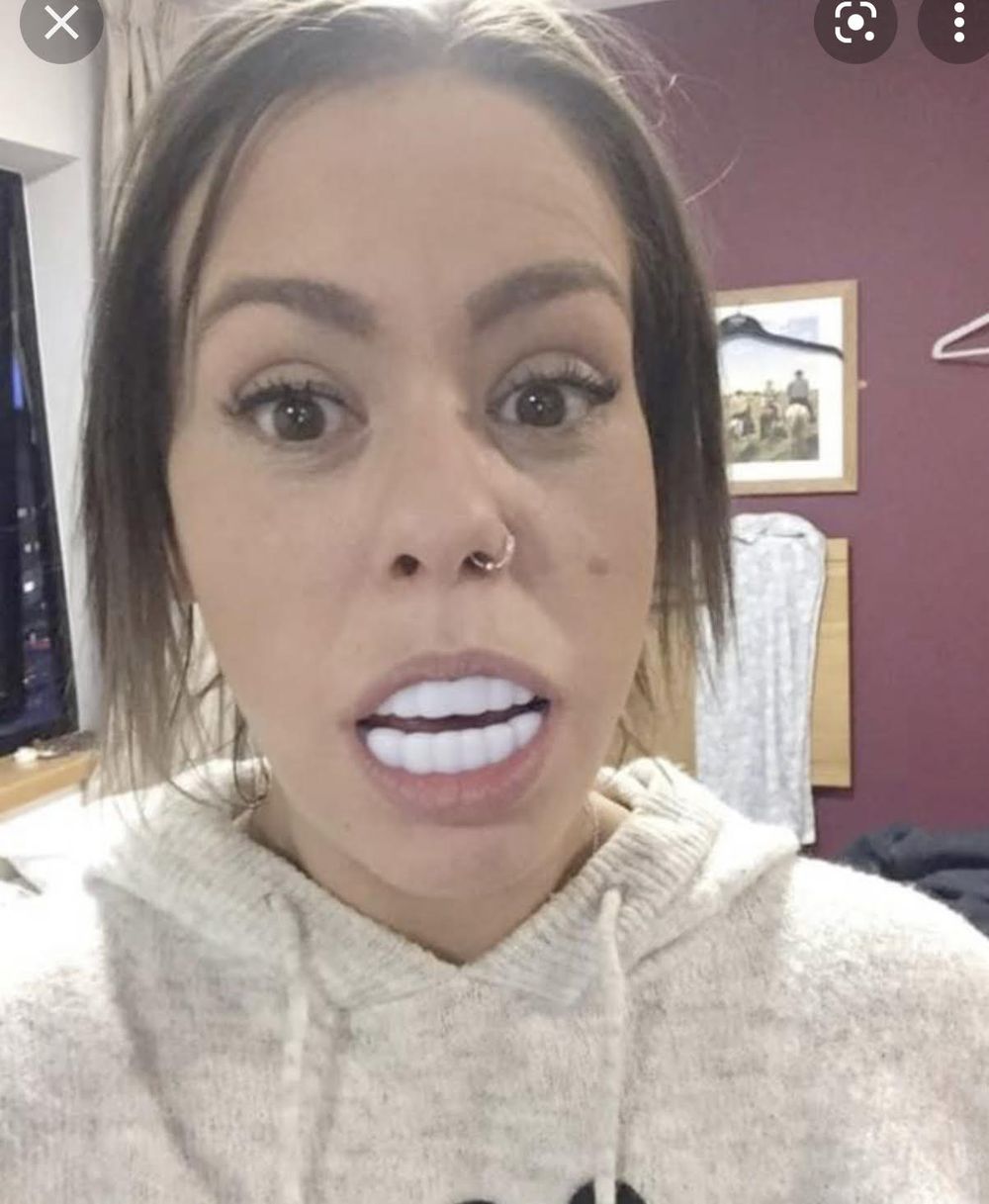 The Truth About Clip On Veneers // 3Dental