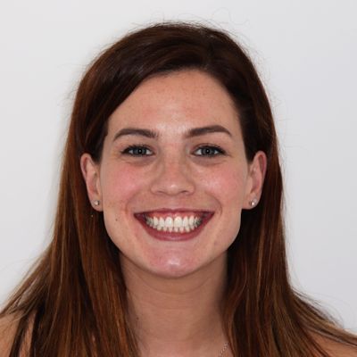 Train Track Braces | Fixed Orthodontic Appliances // 3Dental In Dublin ...