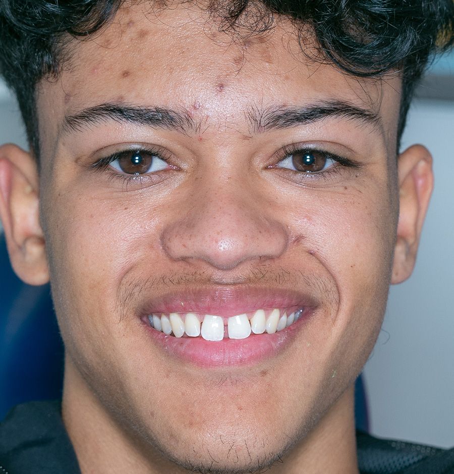 Smile Gallery | Before & Afters | Smile Makeover // 3Dental